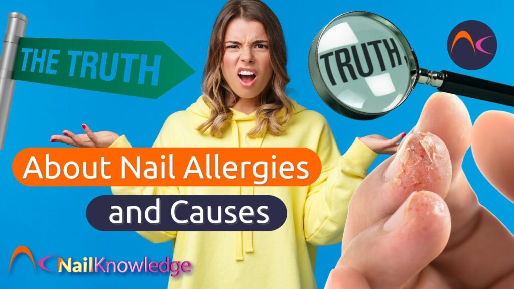 Onycholysis - NailKnowledge