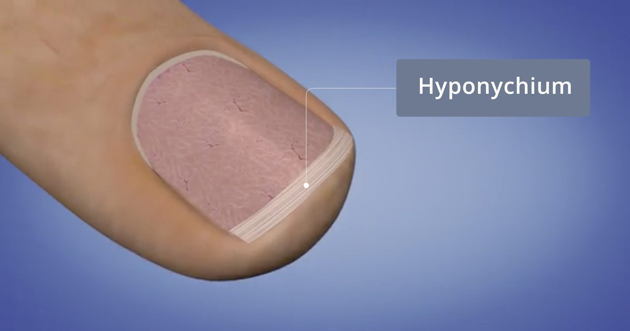 Hyponychium - NailKnowledge