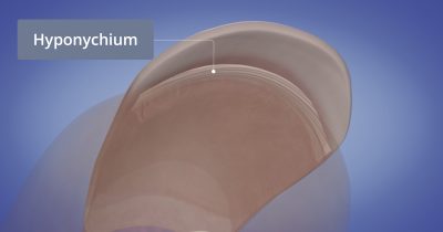 Hyponychium - NailKnowledge