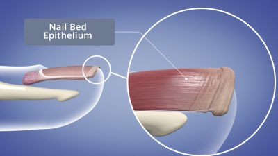 Nail Bed - NailKnowledge