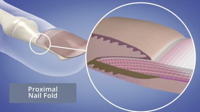 Proximal Nail Fold - NailKnowledge