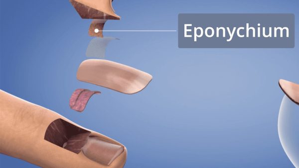 Eponychium - NailKnowledge