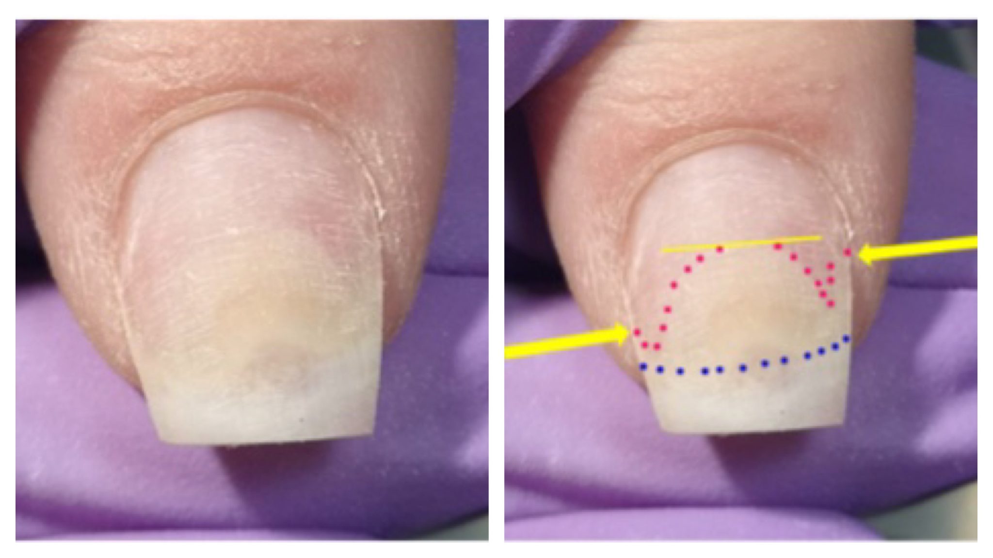 What to look for when rebalancing nail enhancements and why ...