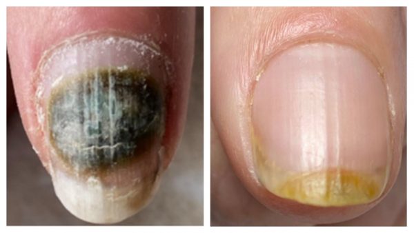 What to look for when rebalancing nail enhancements and why ...