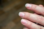Nail Plate Calcium Deficiency: What White Spots Really Mean - NailKnowledge