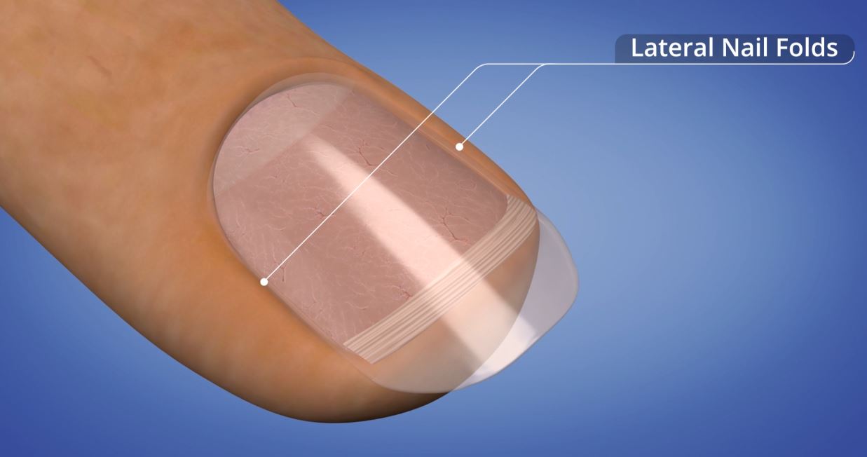 Sidewall - NailKnowledge