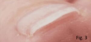 The Nail C-Curve - NailKnowledge