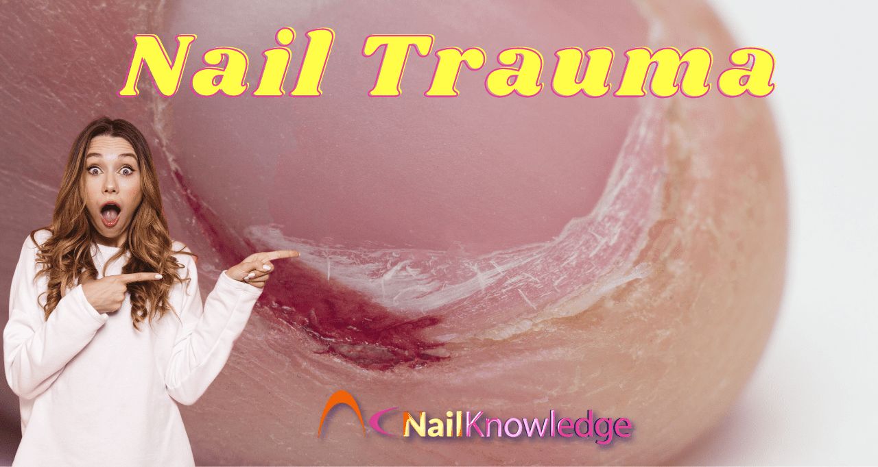 Nail trauma - NailKnowledge