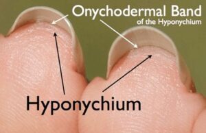 Unlock the Secrets of the Onychodermal Band - NailKnowledge