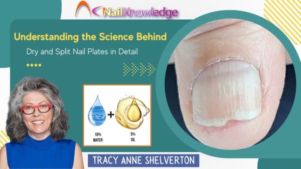 The Science Behind Dry and Split Nail Plates in Detail - NailKnowledge