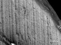 Understanding the Protective Seals of the Nail Bed