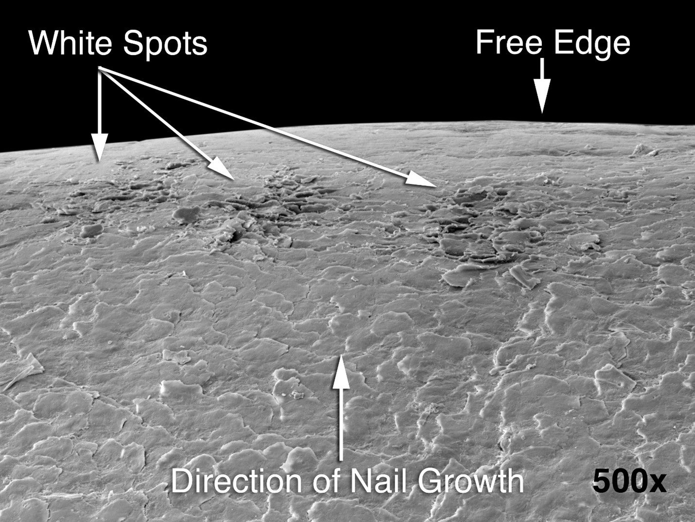 White Spots on Nails After Gel Removal - NailKnowledge